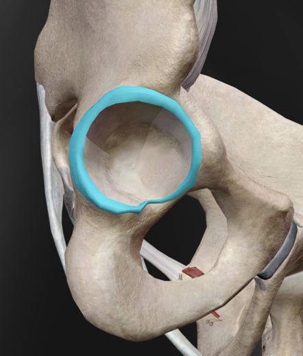 Sinovitis de cadera y cuello femoral - Easy Fisioterapia