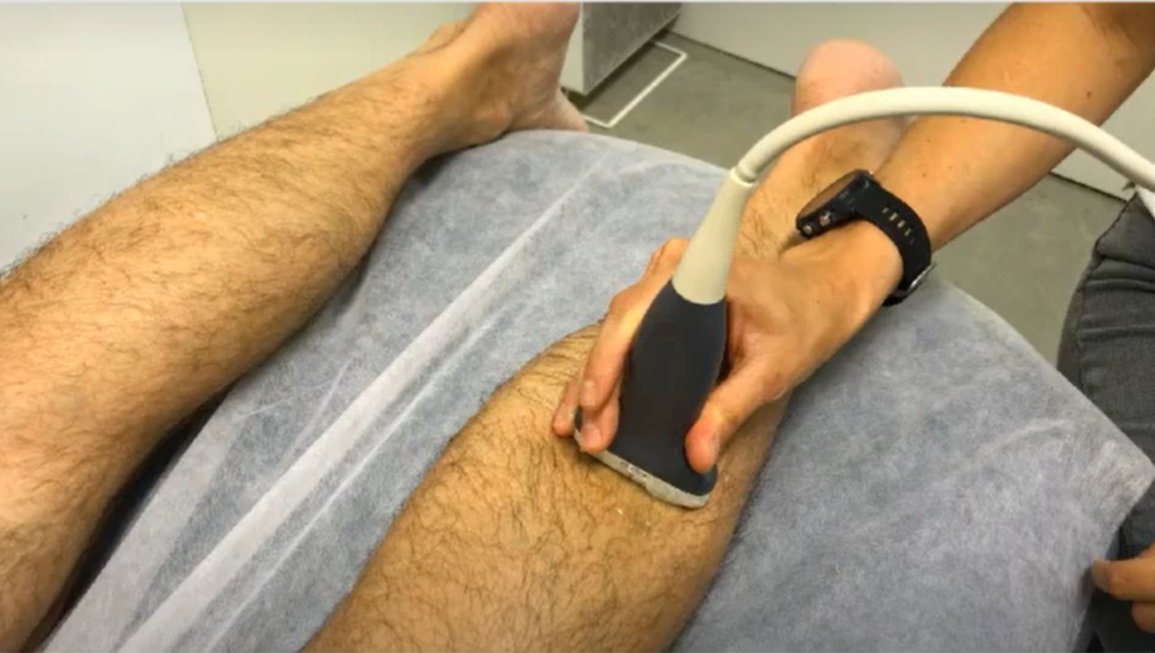 Ecografía en rotura fibrilar de los gemelos y sóleo - Easy Fisioterapia ...